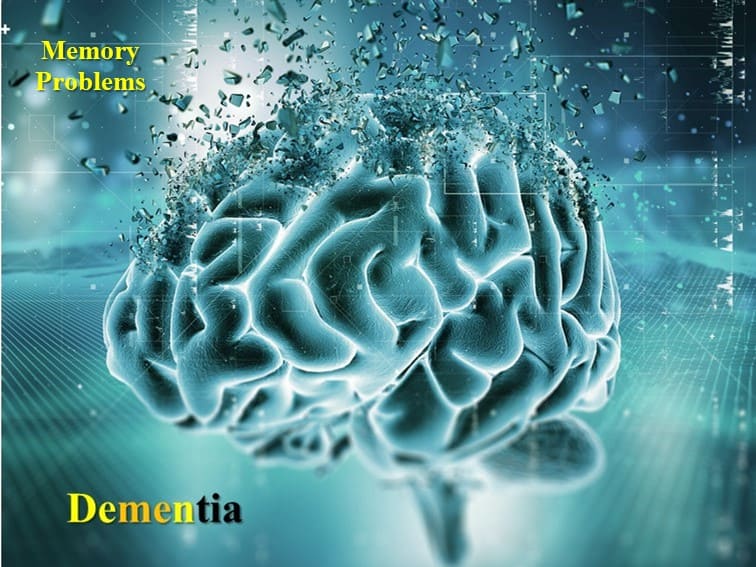 What Is Dementia Dr Vikram Sharma Explains What Is Dementia Dr Vikram Sharma Explains